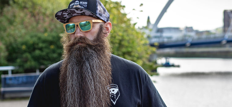 Are You Noticing Beard Hair Falling Out? - Braw Beard